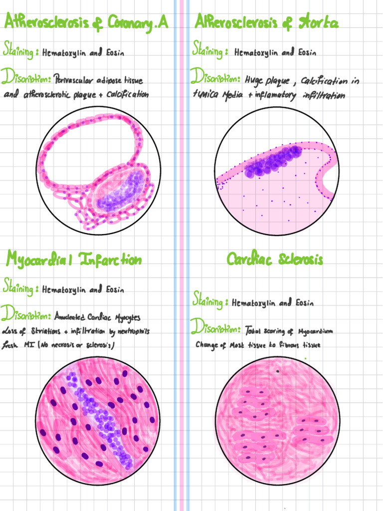 Drawings Pdf Atherosclerosis Atheroma