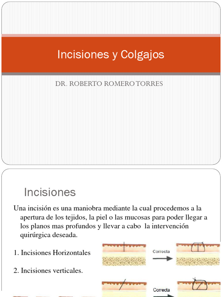 Incisiones y Colgajos en Cirugía Bucal | PDF | Boca | Diente