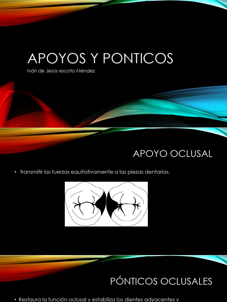 Apoyos y Ponticos | PDF | Diente | Ramas de Odontología