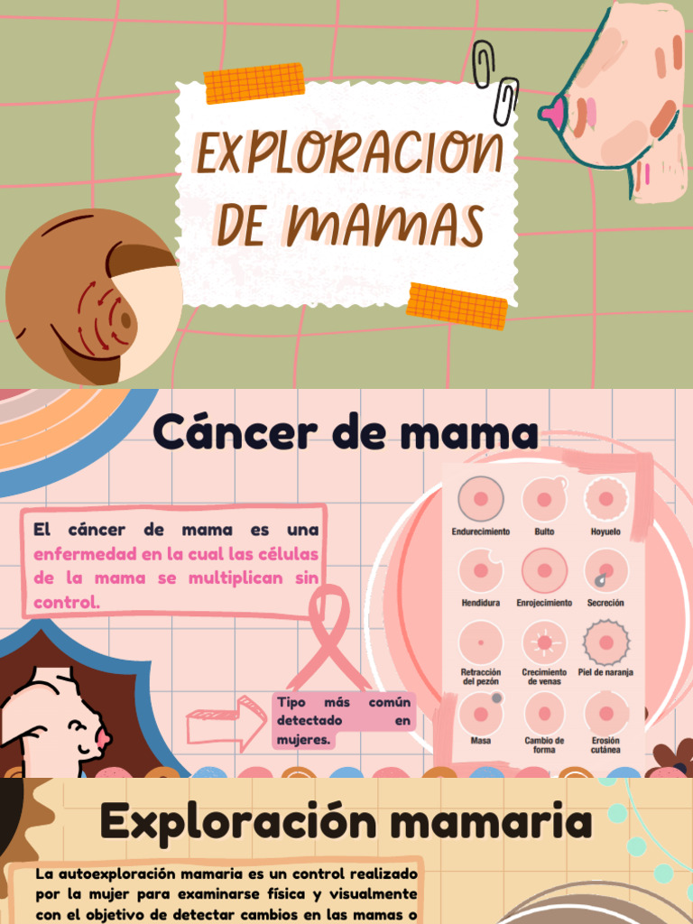 Exploracion de Mamas | Descargar gratis PDF | Pecho | Cáncer de mama