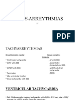 Ventricular Tachycardia - Monomorphic VT - LITFL | PDF ...