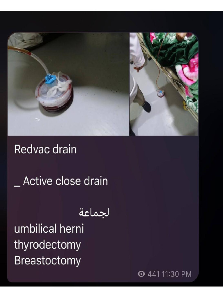 All About Drains | PDF