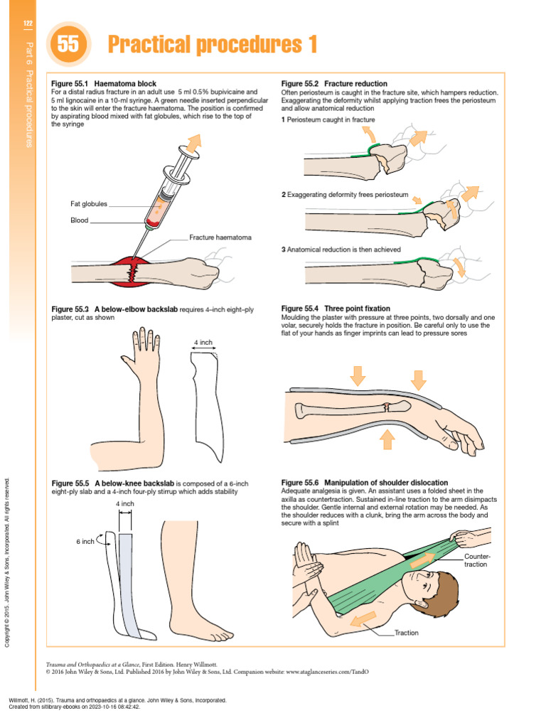 Trauma and Orthopaedics at A Glance - (Part 6 Practical Procedures) | PDF | Arm | Clinical Medicine