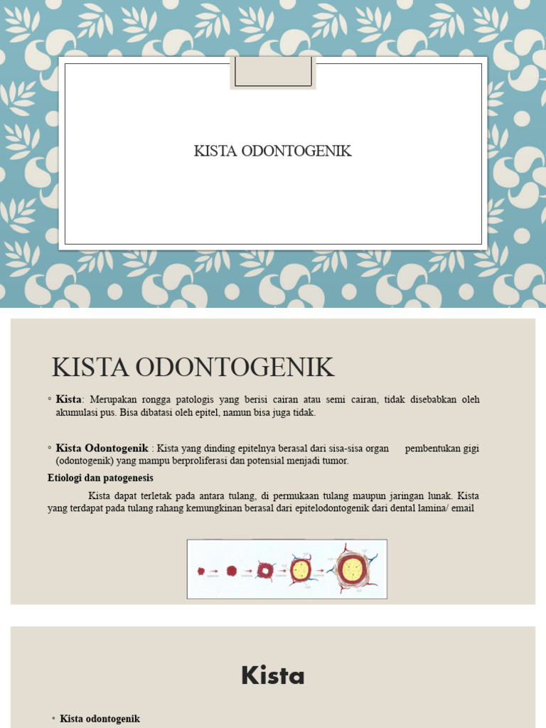 Kista Odontogenik pada Gigi | PDF