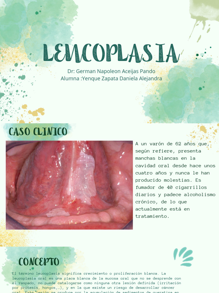Leucoplasia en Piso de La Boca | PDF | Biopsia | Histopatología