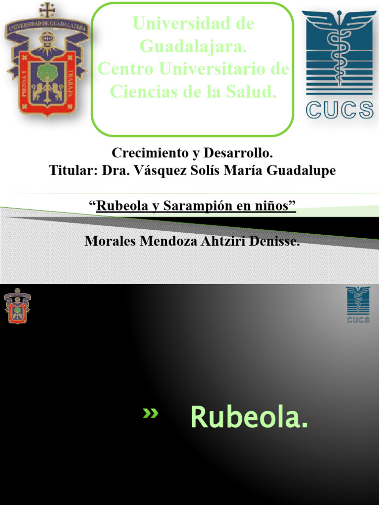 Rubeola y Sarampión en Niños: Diagnóstico y Tratamiento | PDF ...