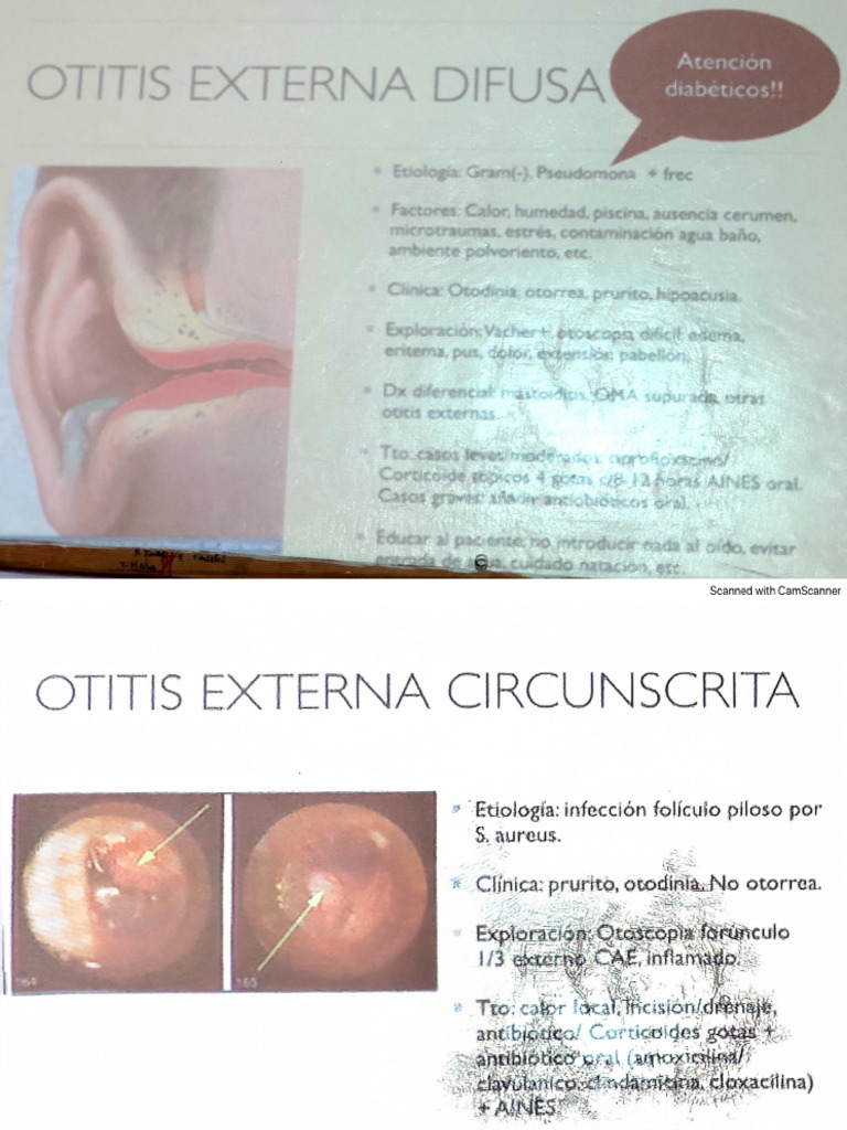 Otitis Externa y Otitis Media | PDF