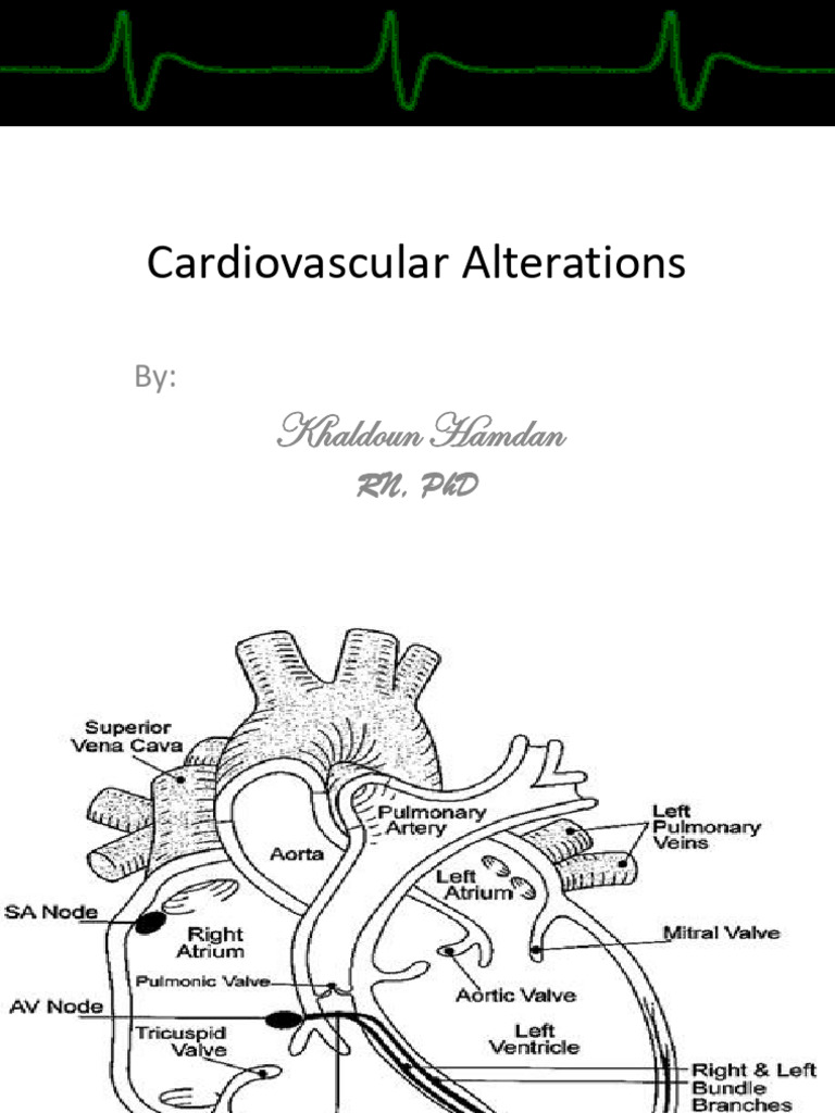 Cardiovascular Alterations | Download Free PDF | Electrocardiography ...