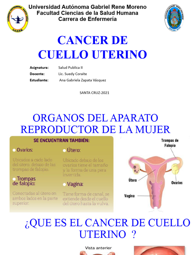 Cancer de Cuello Uterino | PDF | Cáncer de cuello uterino | Especialidades Medicas