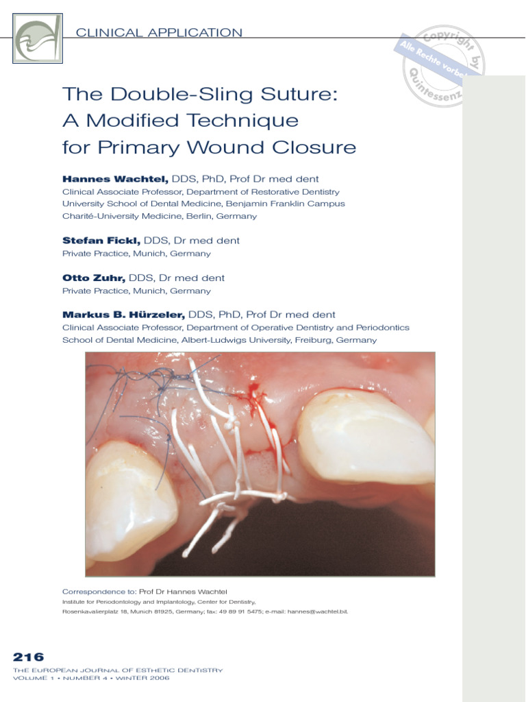 Wachtel2006 19655501 | PDF | Surgical Suture | Periodontology