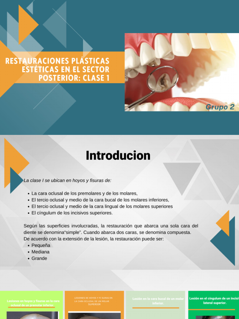 Restauraciones Plásticas Estéticas en El Sector Posterior Clase 1 | PDF