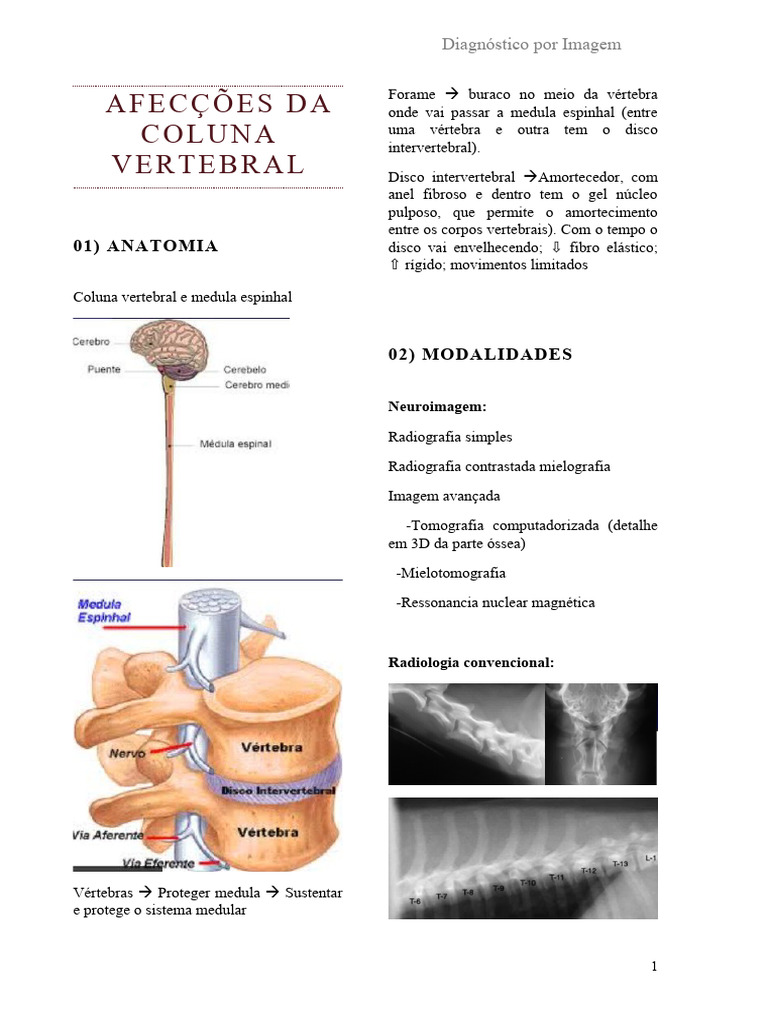 04) Afecções Da Coluna Vertebral | PDF | Coluna vertebral | Imagiologia ...