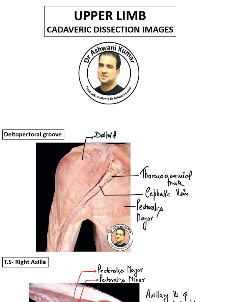 Anatomy Cadaveric Images by Dr. ASHWANI KUMAR | PDF | Human Leg | Anatomy