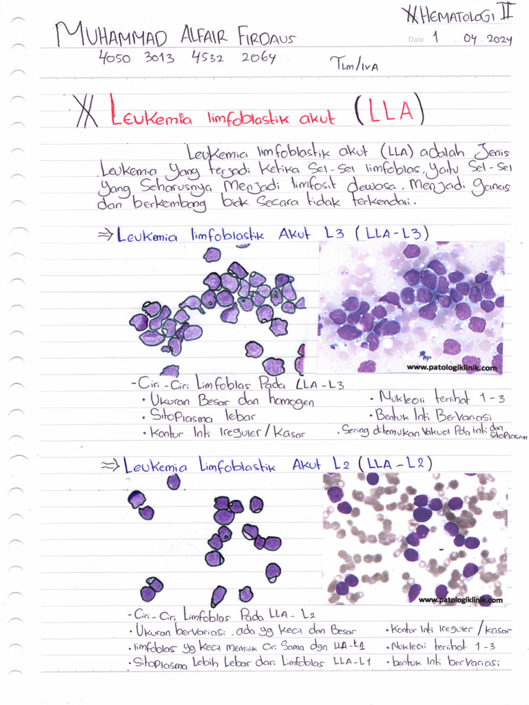 Muhammad Alfair Firdaus TGS Leukemia Lla Dan Lma Hematologi Ii | PDF