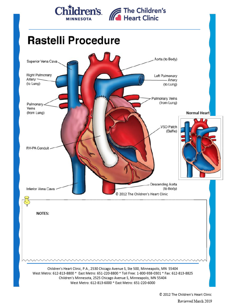 rastelli | PDF | Ventricle (Heart) | Heart