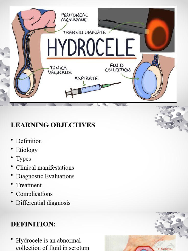 Hydrocele | PDF