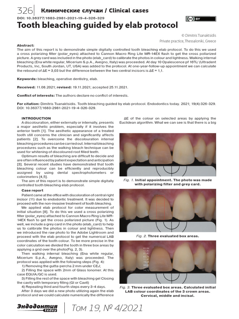 Tooth bleaching guided by elab protocol | PDF | Tooth | Mouth