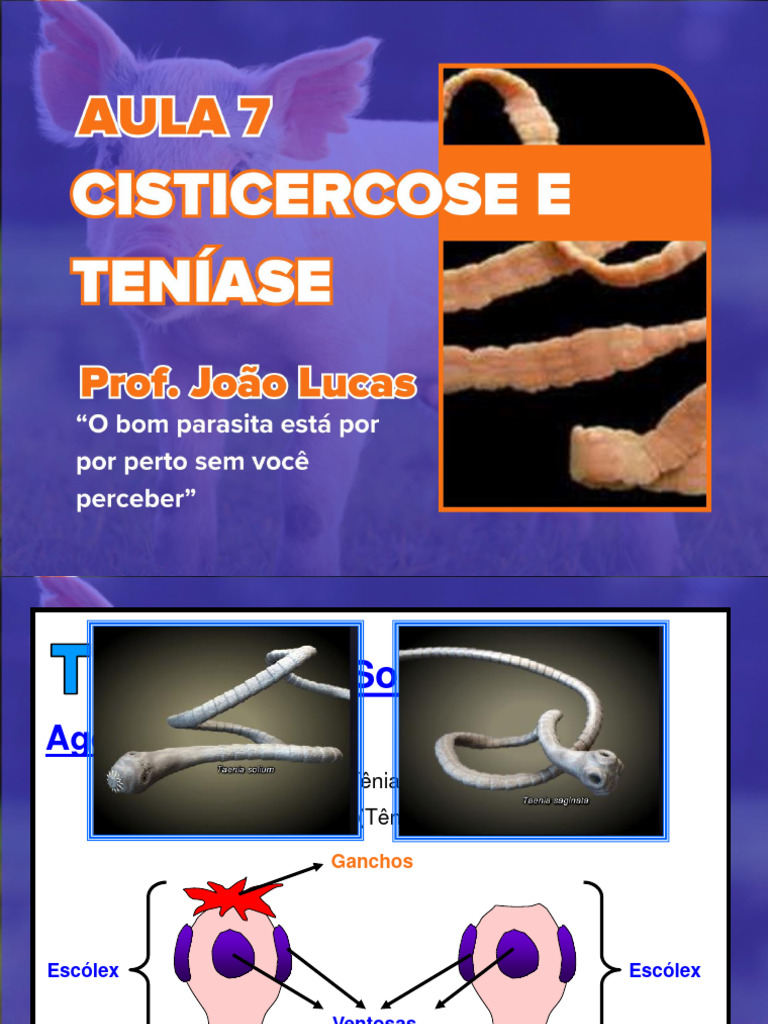 Aula 07- Teníase e Cisticercose | PDF
