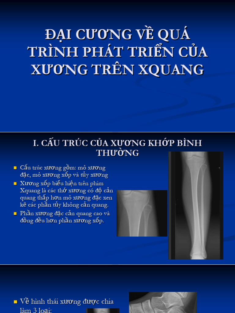 Giải Phâu Xqung Khơp Vai | PDF
