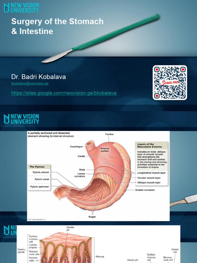 Surgery2 07 Stomach and Small Intestine | PDF | Stomach | Metastasis