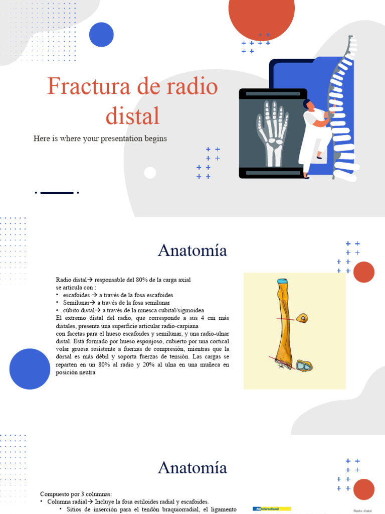 Fractura Radio Distal | PDF | Extremidades (anatomía) | Sistema ...