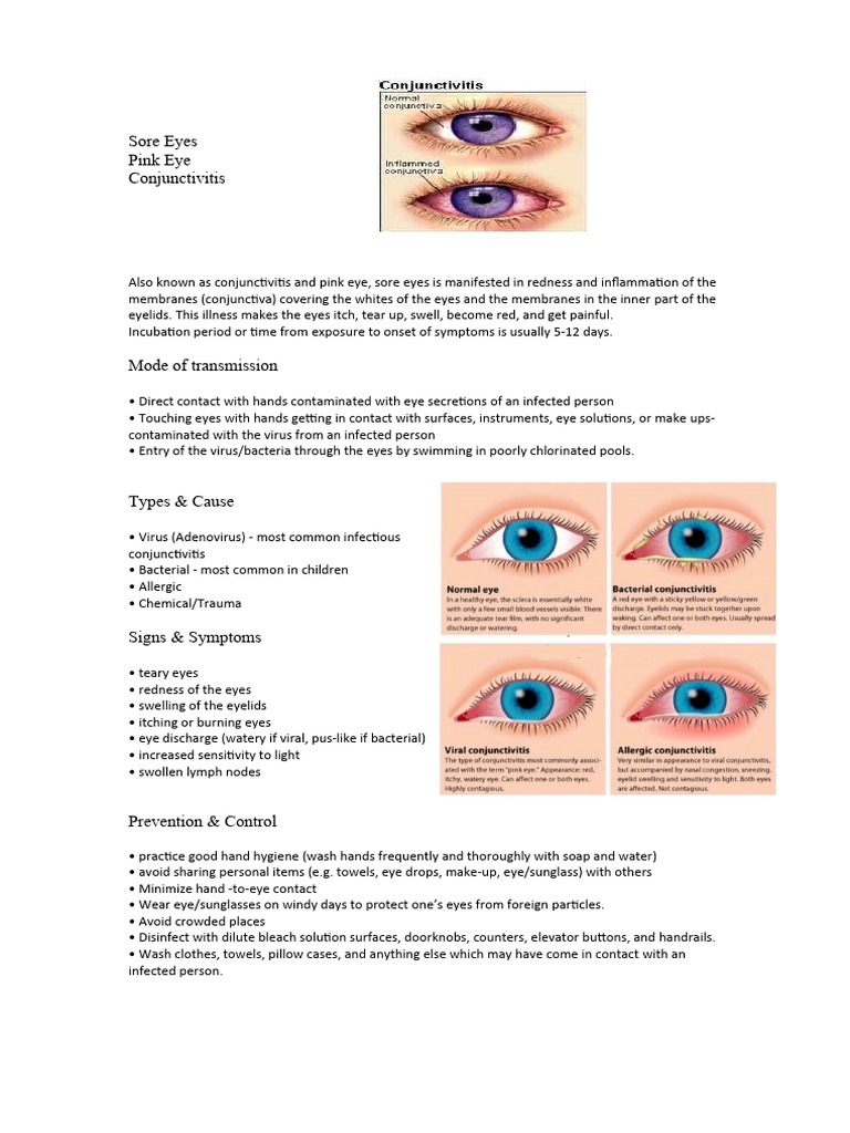 CONJUNCTIVITIS | PDF | Health Sciences | Medical Specialties