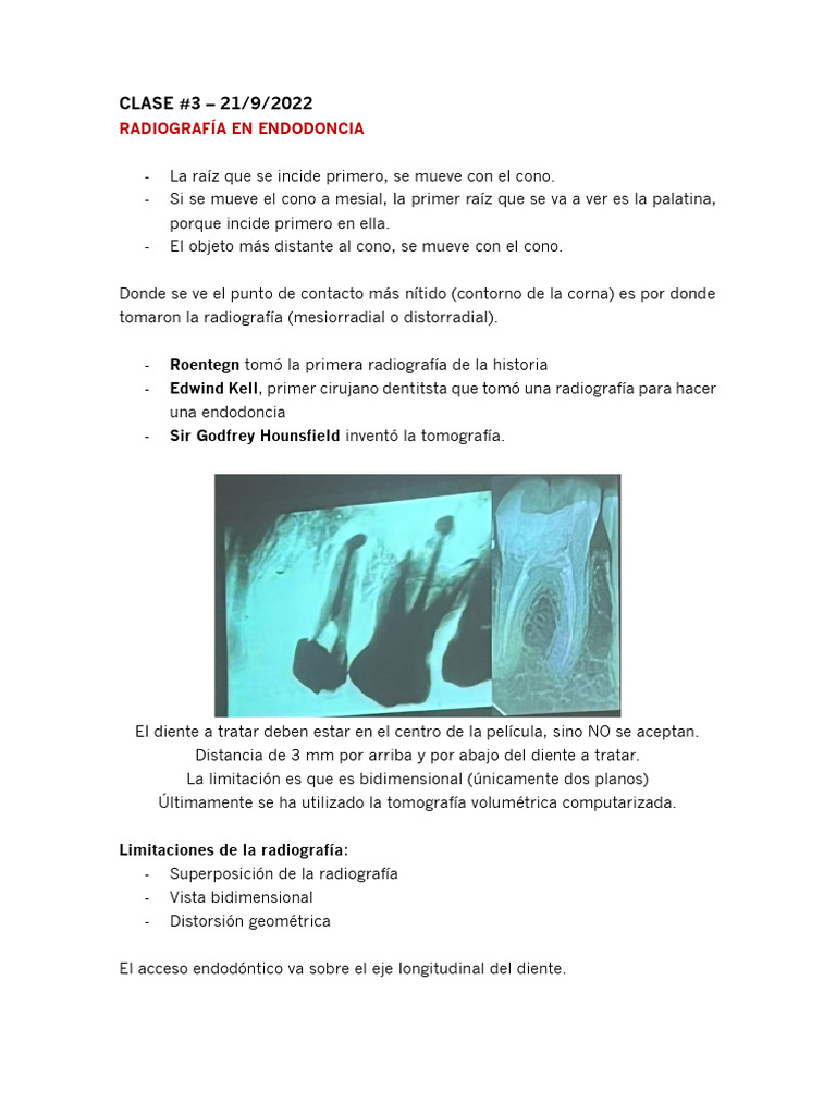 Radiografía y Tomografía en Endodoncia | PDF | Ct Scan | Especialidades ...