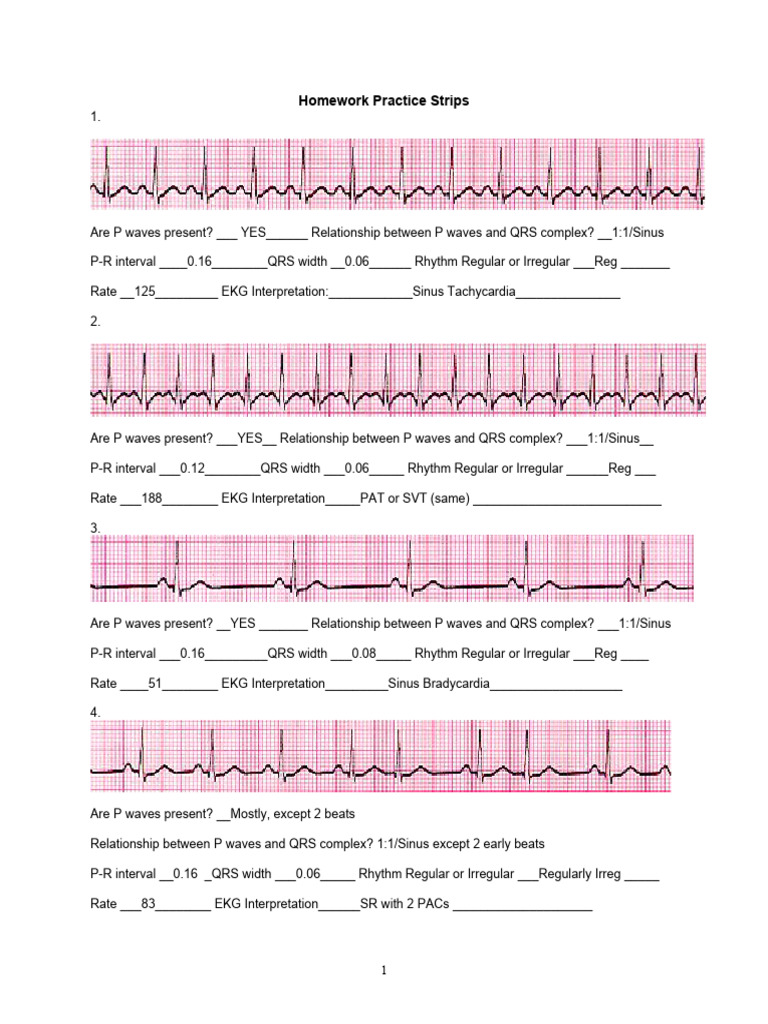 Week 3 Answered ECG Homework Handout | PDF | Electrocardiography ...