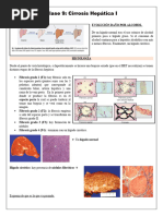 Escala de Child para La Cirrosis Hepática | PDF