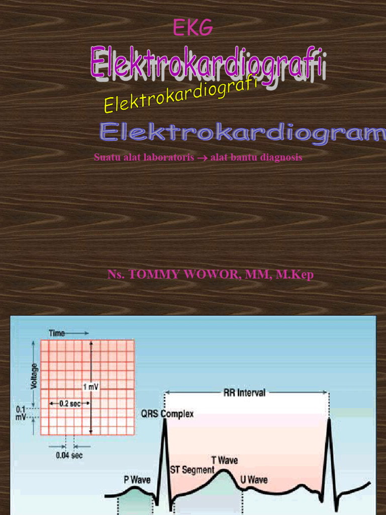 Basic EKG | PDF