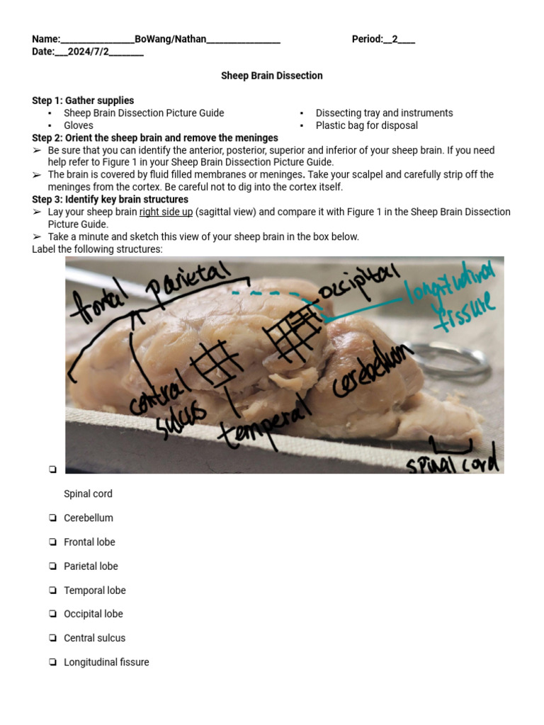 Sheep Brain Dissection | PDF | Brain | White Matter