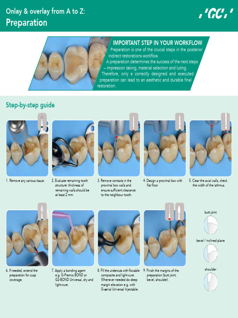 MAN Indirect Restorative Technique Cards en | PDF | Dentistry Branches ...
