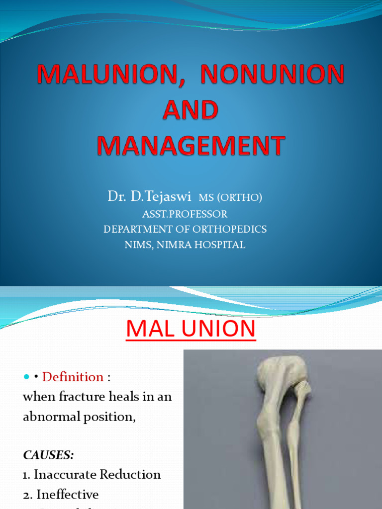 S-Malunion and Nonunion | PDF | Surgical Specialties | Clinical Medicine