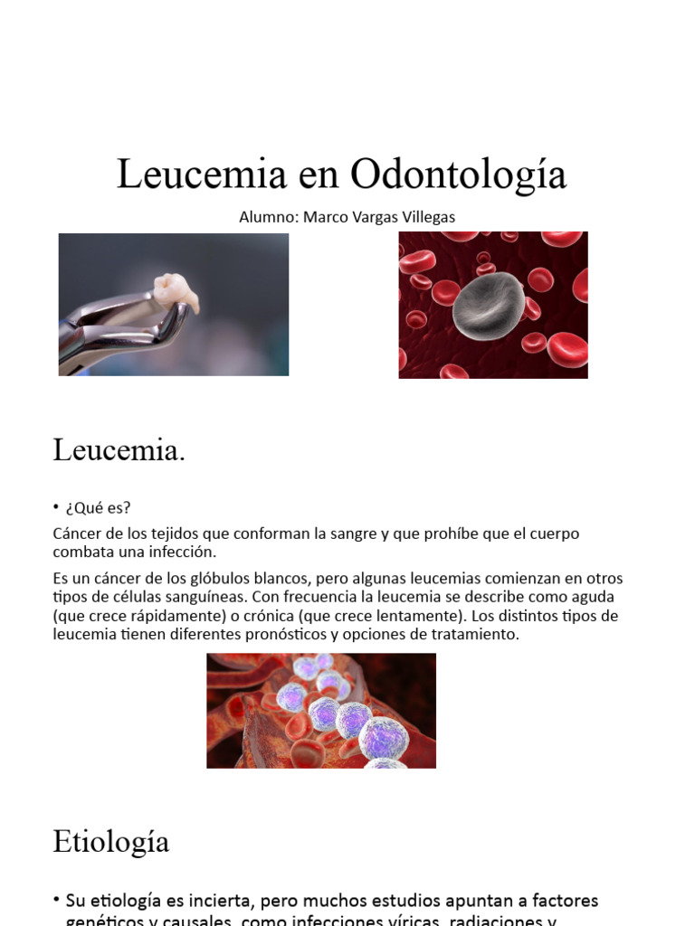 Leucemia y su Impacto Odontológico | PDF | Leucemia | Odontología