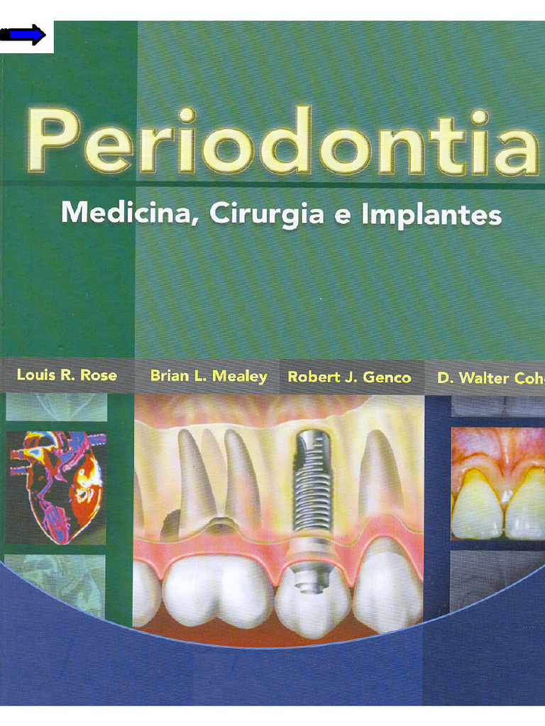 Periodontia Medicina Cirurgia e Implantes - Louis Rose | PDF