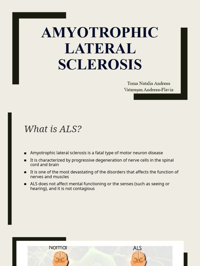 Amyotrophic Lateral Sclerosis | PDF | Stephen Hawking | Clinical Medicine