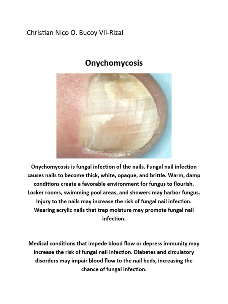 Nico 1 | PDF | Nail (Anatomy) | Genetic Disorder