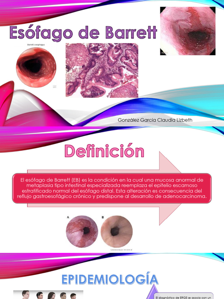Esófago de Barret | PDF | La enfermedad por reflujo gastroesofágico ...