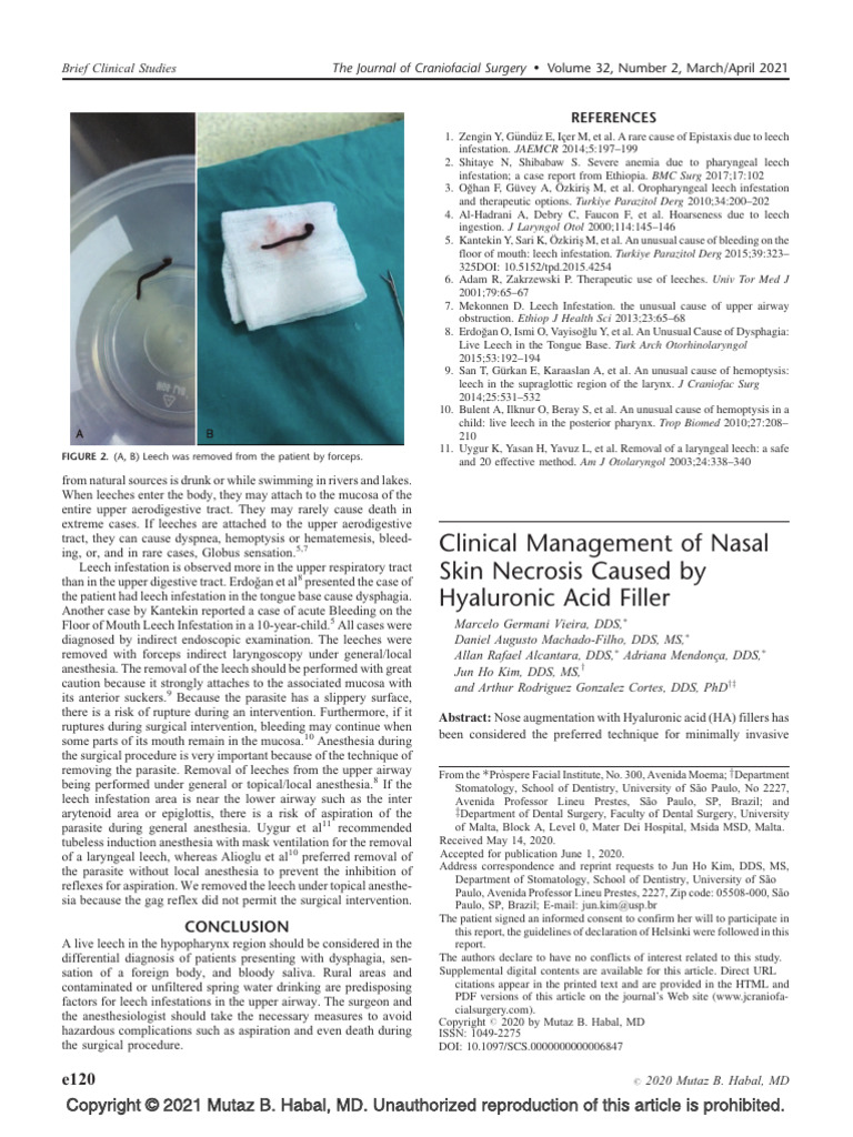 Clinical_Management_of_Nasal_Skin_Necrosis_Caused.95 | PDF | Surgery ...
