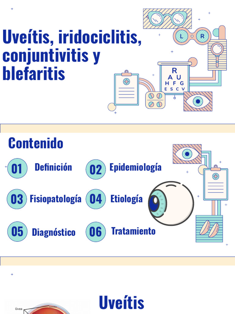 Uveítis, Iridociclitis, Conjuntivitis y Blefaritis | Descargar gratis PDF | Enfermedades y ...