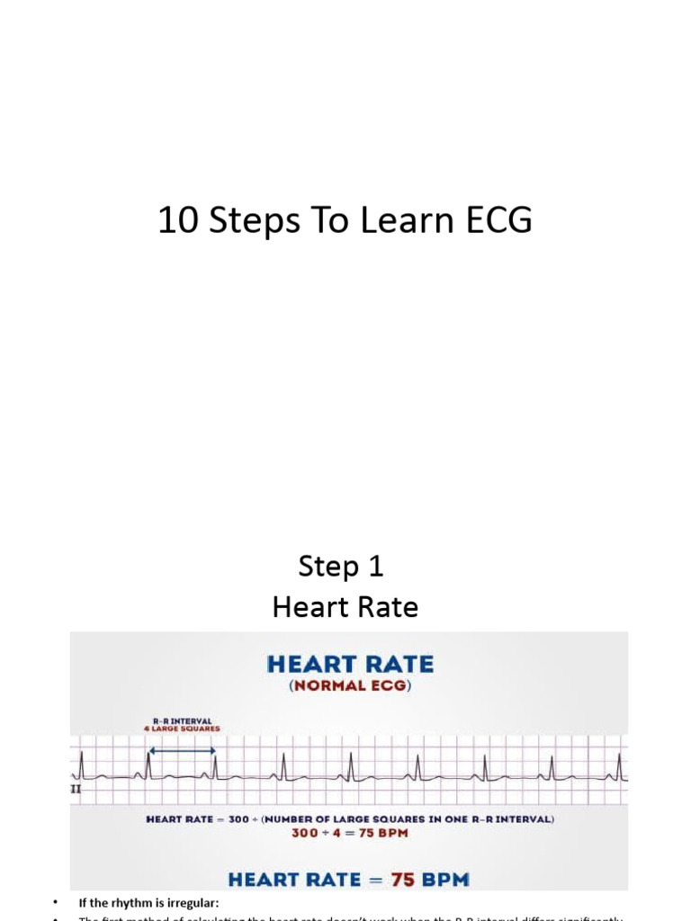 10 Steps To Learn ECG - IAN | PDF | Heart Rate | Circulatory System