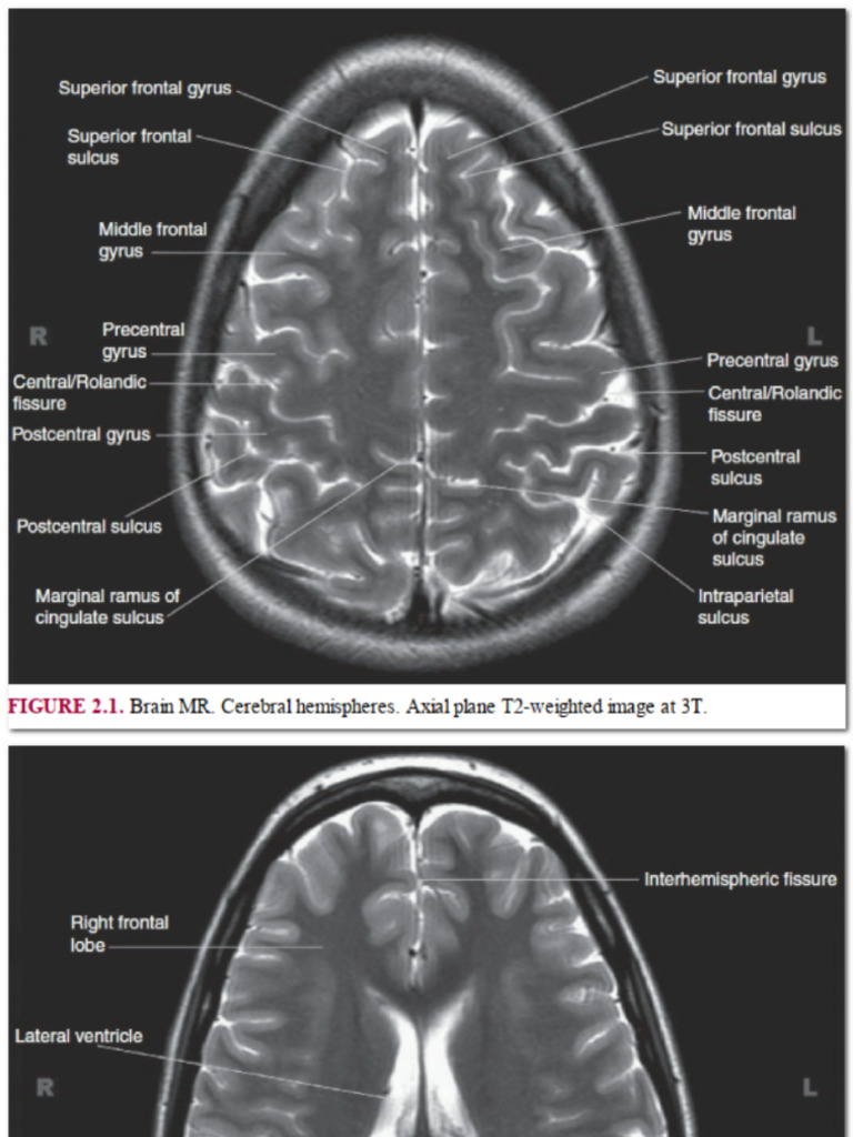 SNC Anatomia RM | PDF