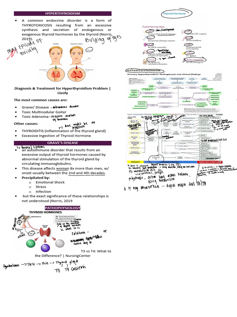 Hyperthyroid Is M | PDF | Hyperthyroidism | Thyroid