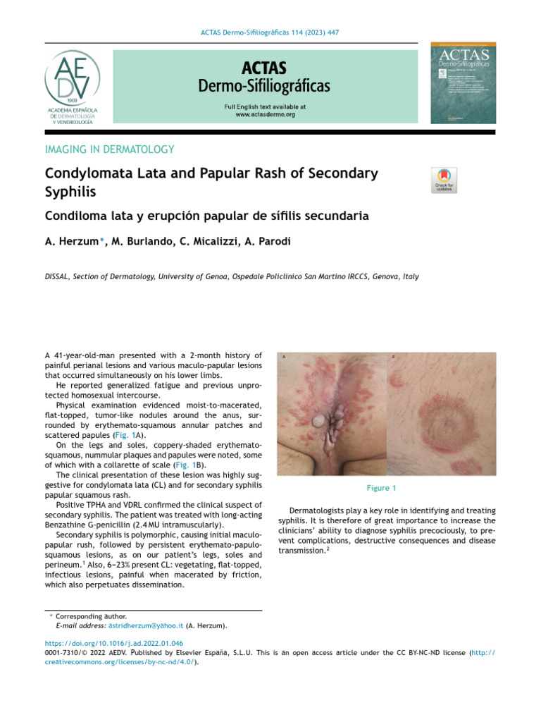 Condyloma Lata | PDF | Clinical Medicine | Dermatology