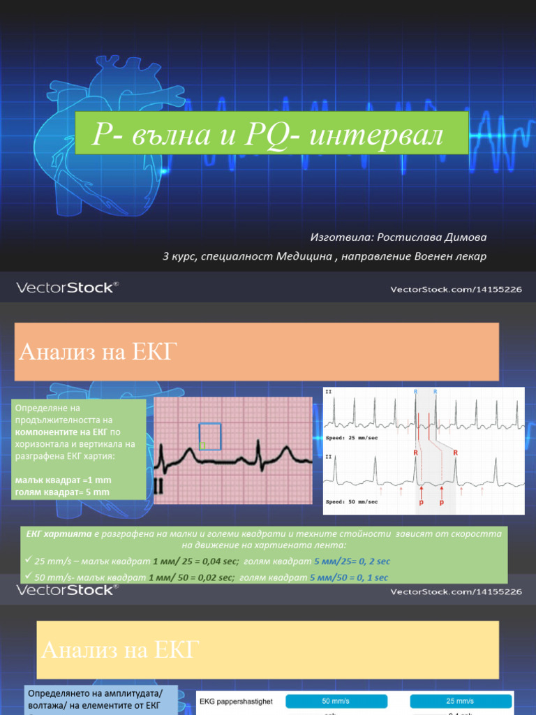 P Вълна и PQ Interval | PDF