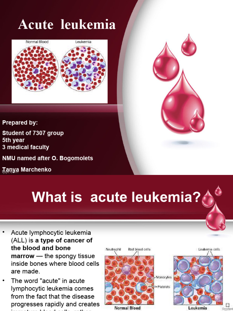 Acute leukemia_ | PDF | Lymphocyte | Haematopoiesis