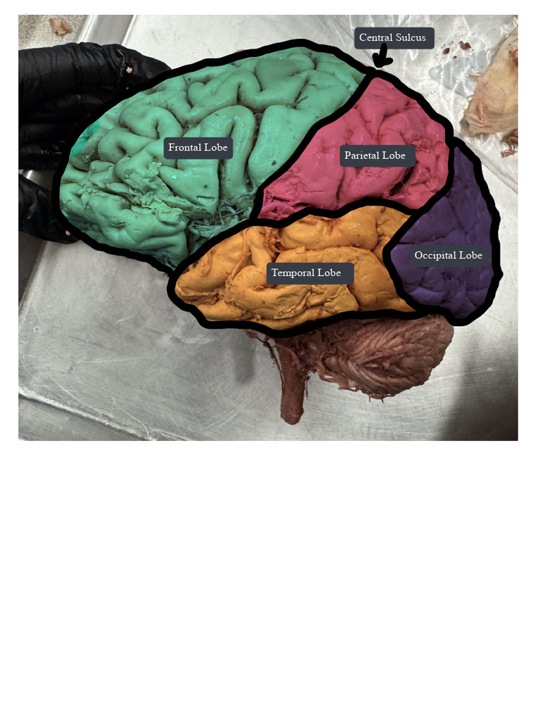 Neuroanatomy Gyri Drawings - Maya Greenquist | PDF | Frontal Lobe ...