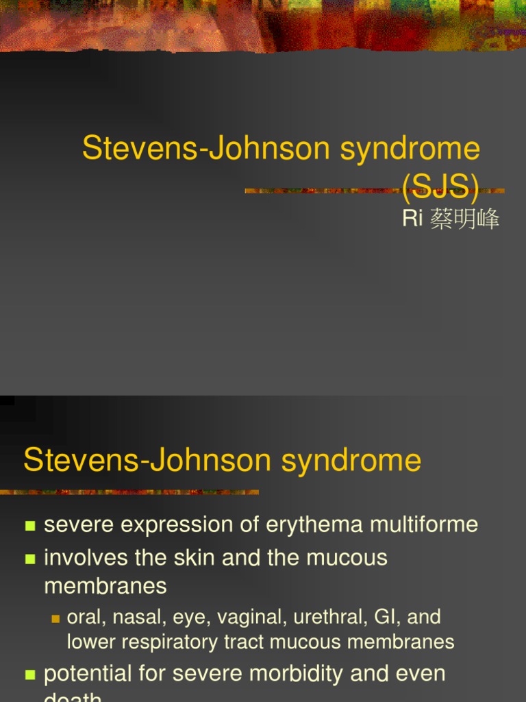 Stevens-Johnson Syndrome (SJS) | PDF | Immunology | Epidemiology