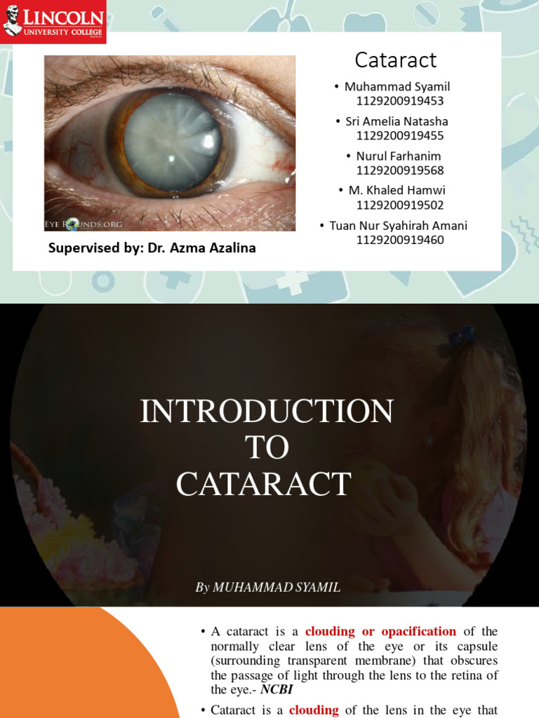 Cataract | PDF | Clinical Medicine | Medical Specialties