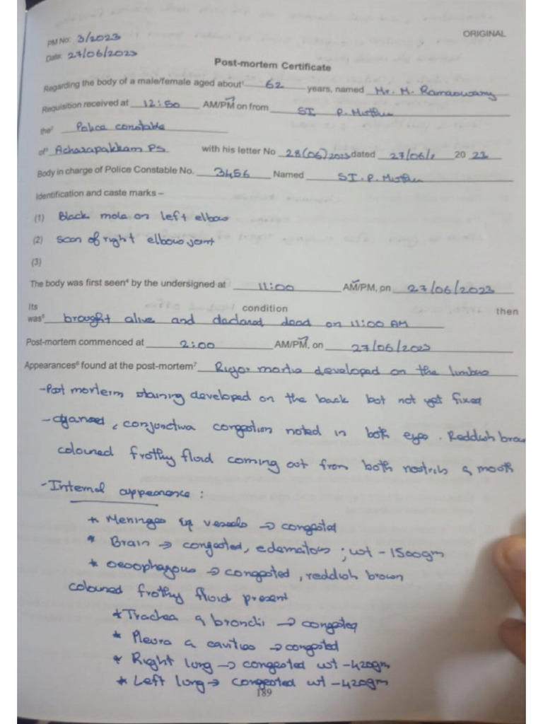 PM Report Mr.M.ramaswamy | PDF